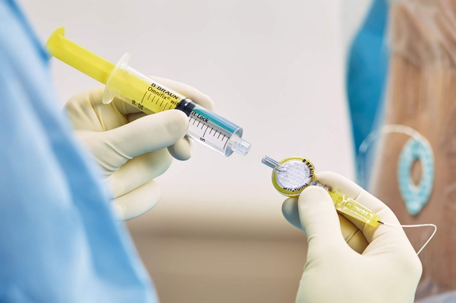 NRFit, une norme pour plus de sécurité en anesthésie loco-régionale - B ...